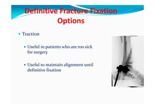 General principles of fractures treatment 1.pdf