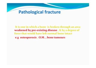 General principles of fractures treatment 1.pdf
