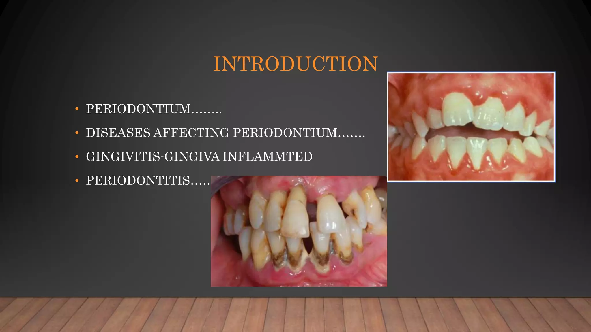 General principles of periodontal surgery | PPTX