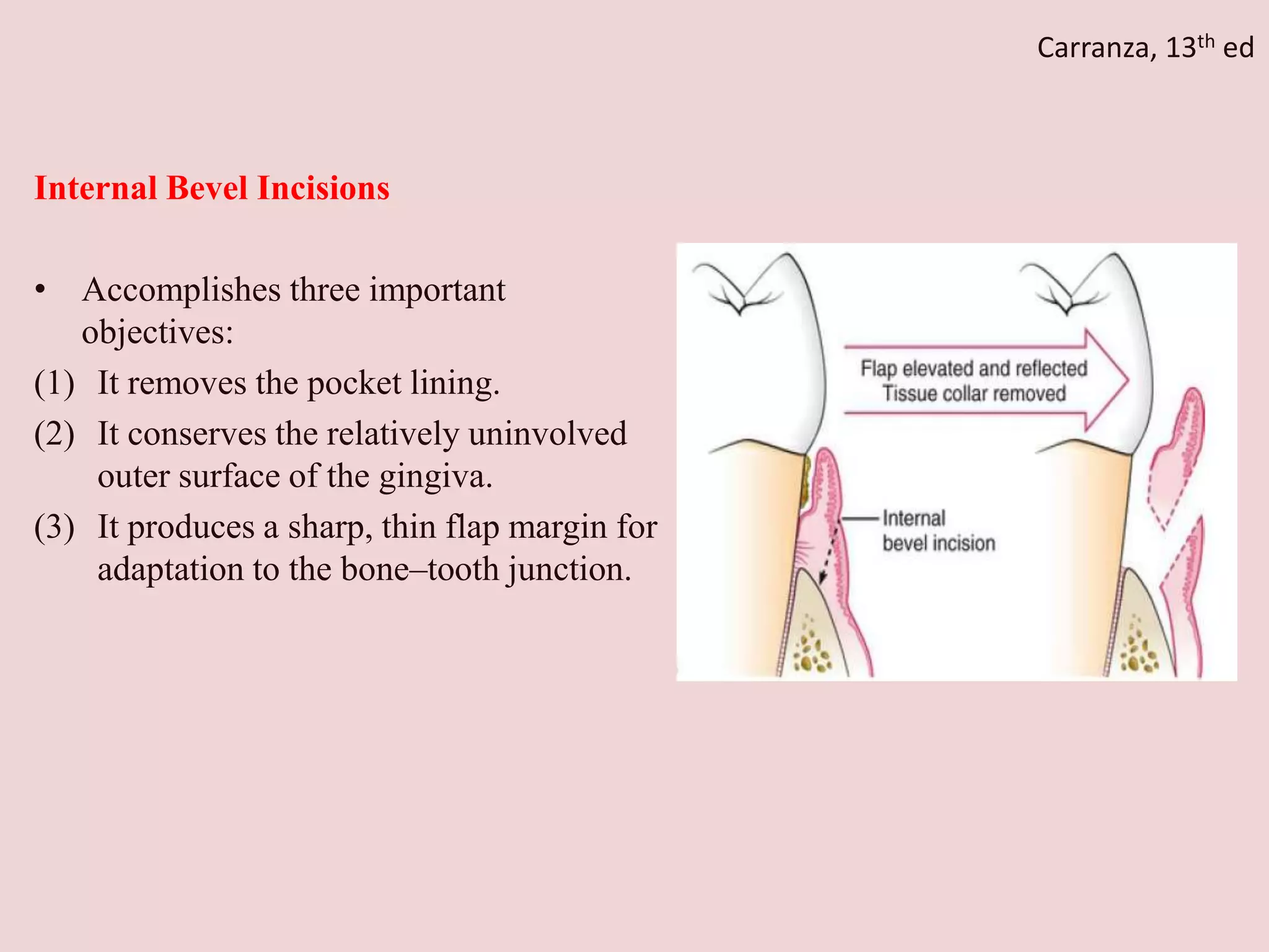 General principles of periodontal surgery | PPTX