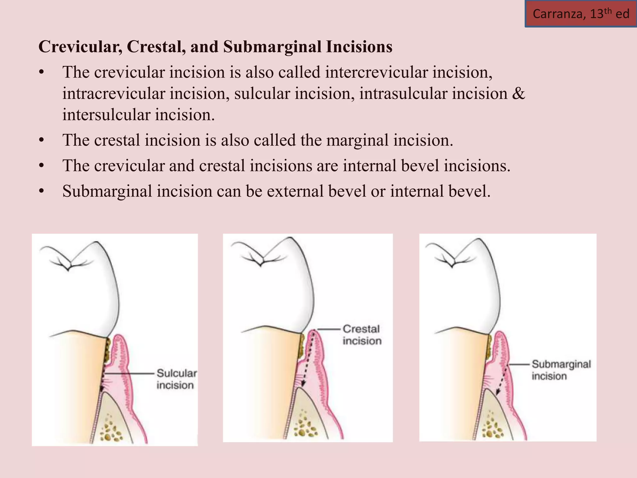 General principles of periodontal surgery | PPTX