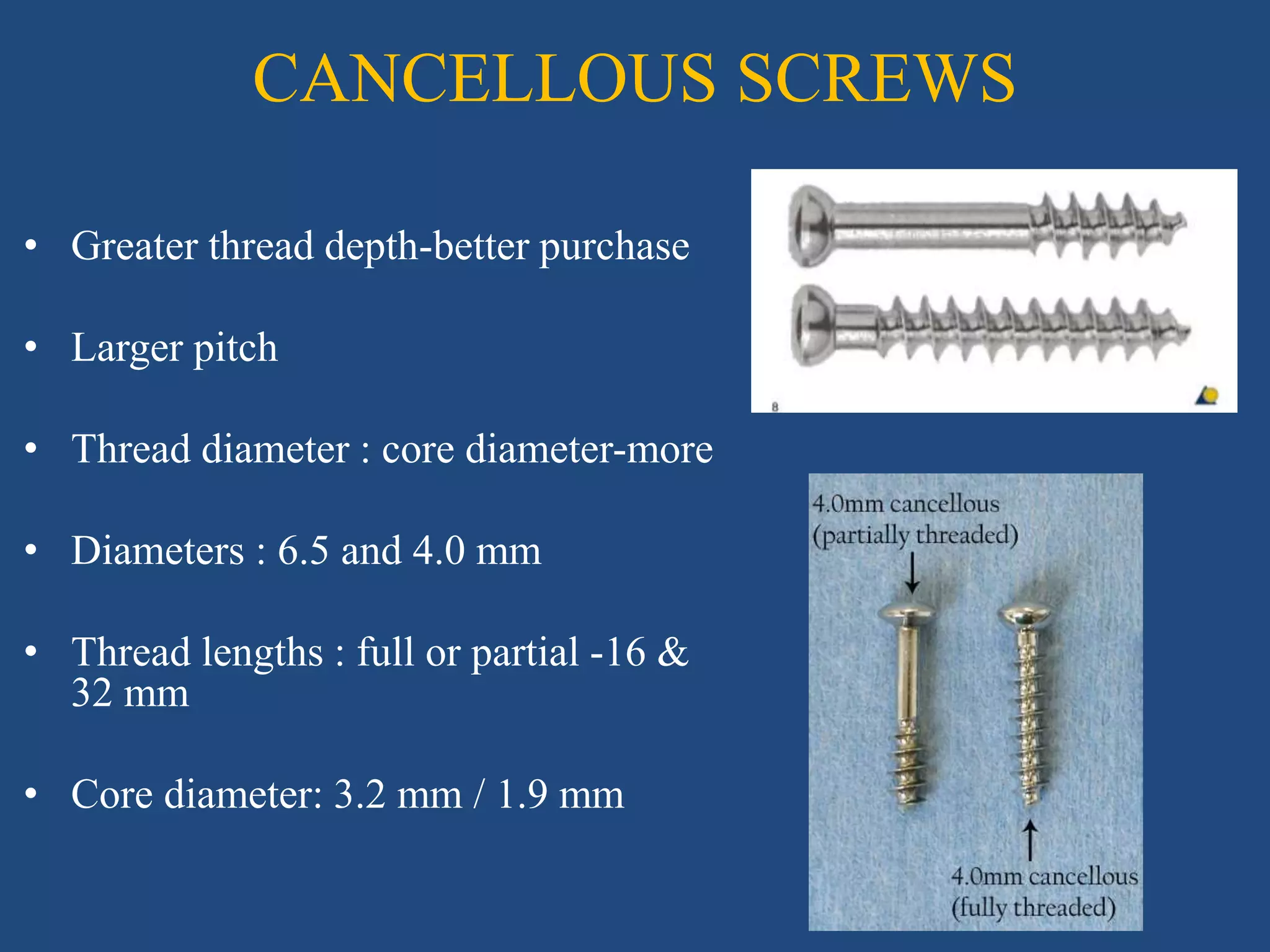 Plating principles in Orthopaedics | PPTX