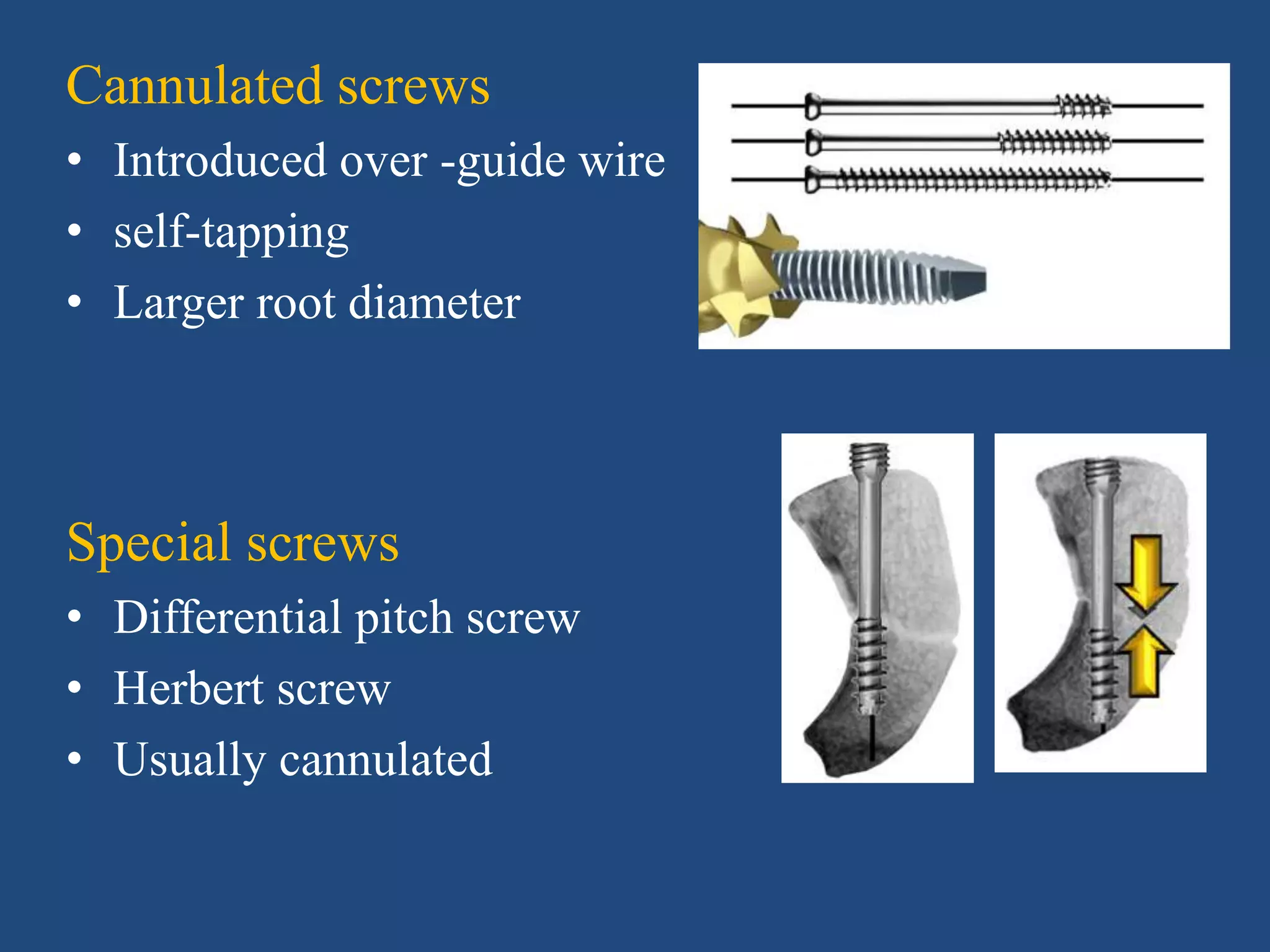 Plating principles in Orthopaedics | PPTX