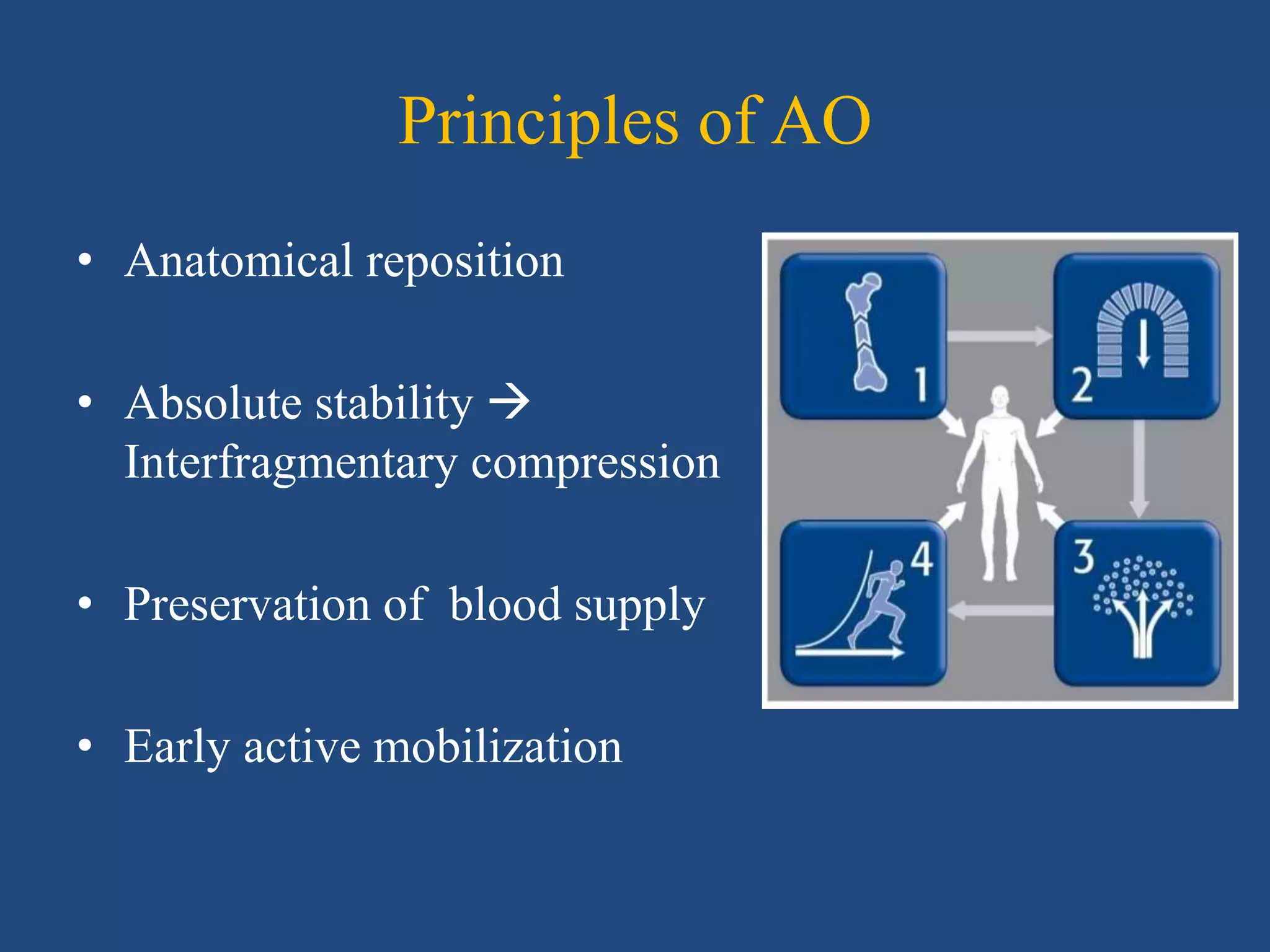 Plating principles in Orthopaedics | PPTX