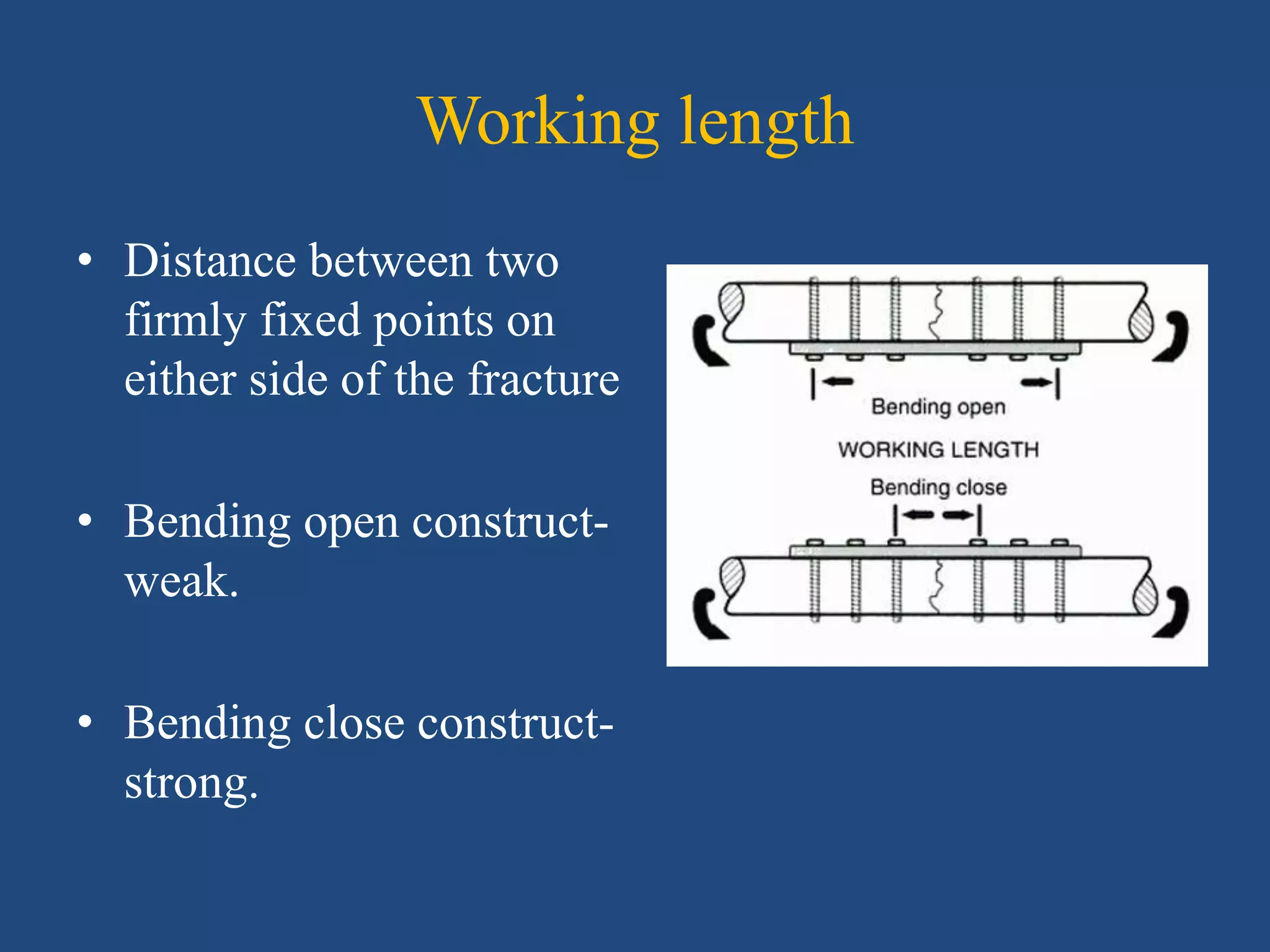 Plating principles in Orthopaedics | PPTX