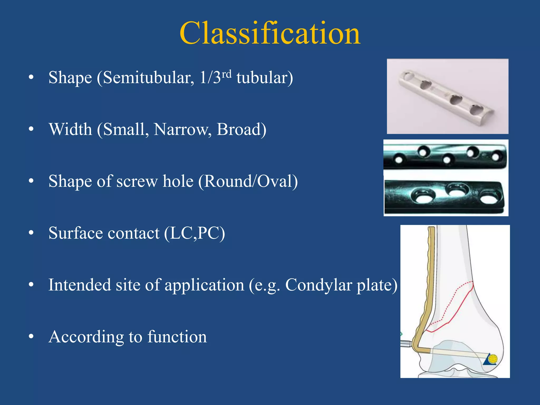 Plating principles in Orthopaedics | PPTX