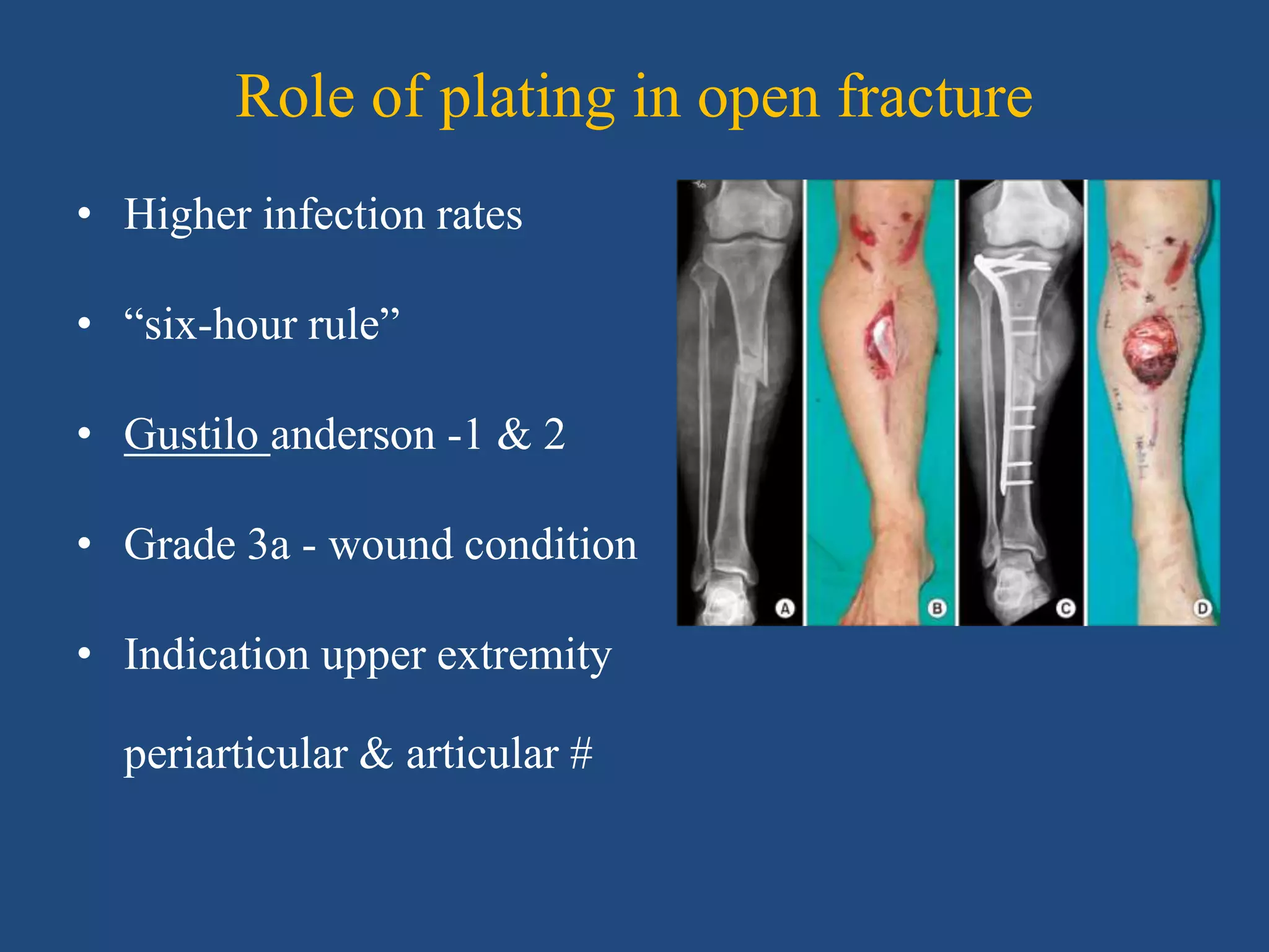 Plating principles in Orthopaedics | PPTX