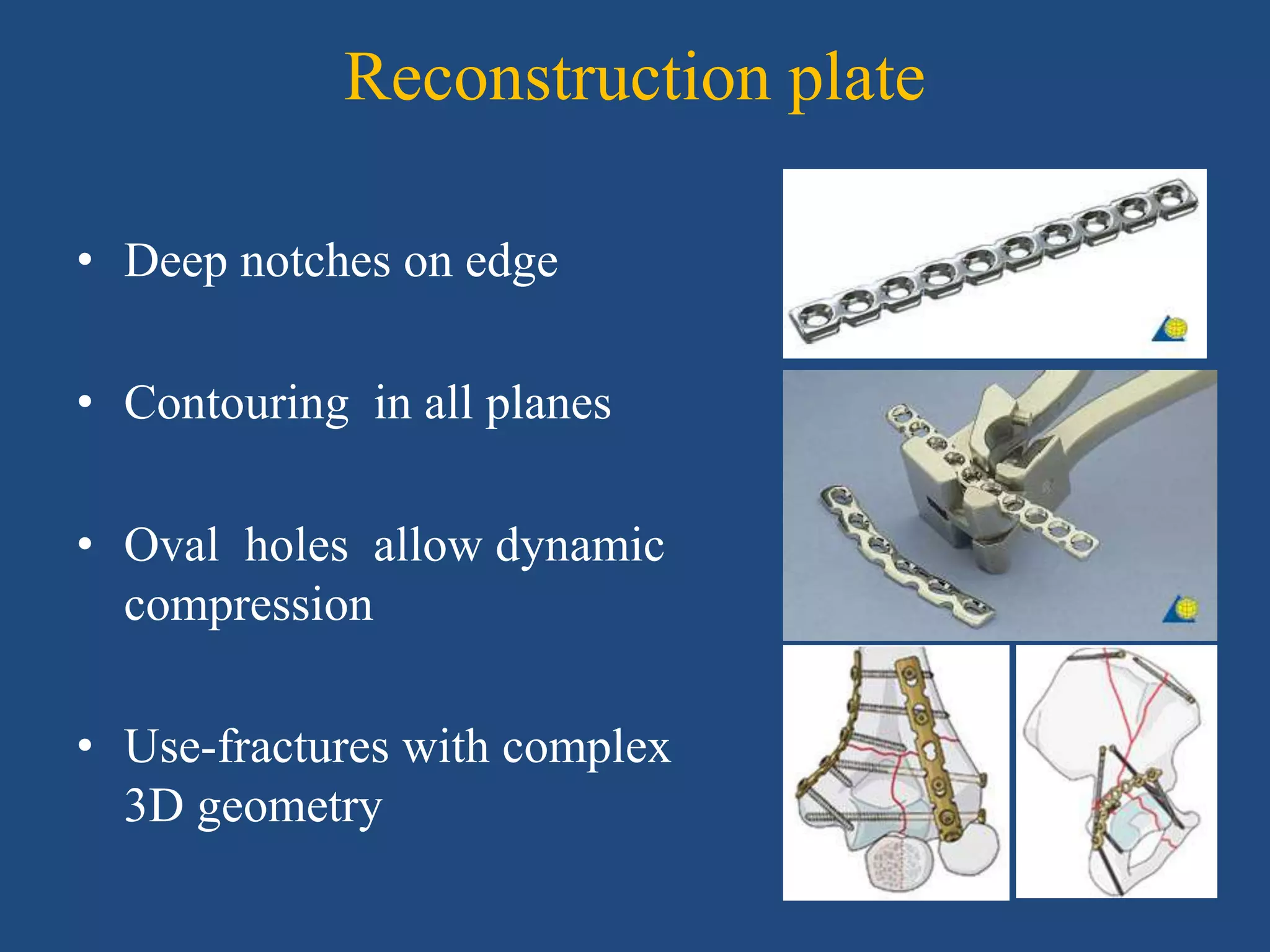 Plating principles in Orthopaedics | PPTX