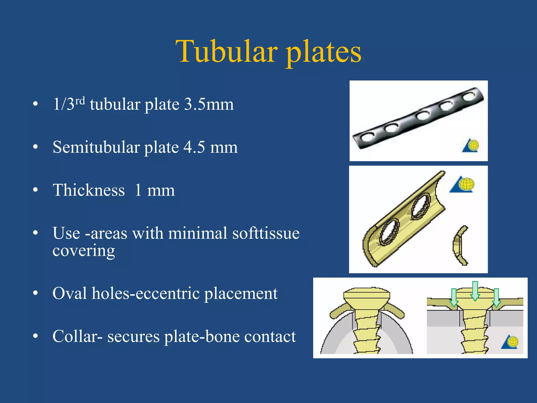 Plating principles in Orthopaedics | PPTX