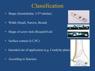 Plating principles in Orthopaedics | PPTX