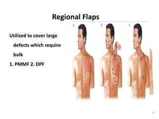 By Dr Dagmawi GeremewGeneral Principles of Skin Graft and Flaps | PPTX