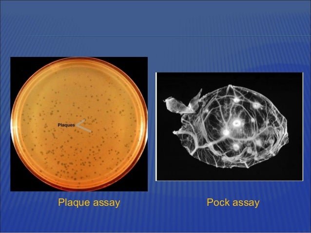 General properties of viruses