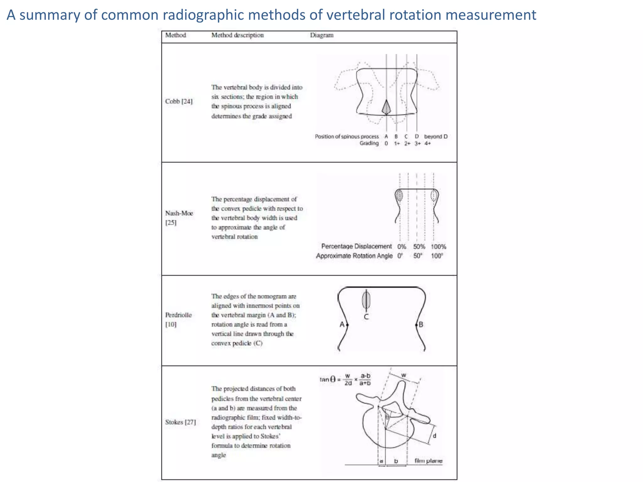 General radiologic measurement of scoliosis 복사본 | PPTX
