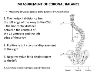 General radiologic measurement of scoliosis 복사본 | PPTX | Death, Injury ...