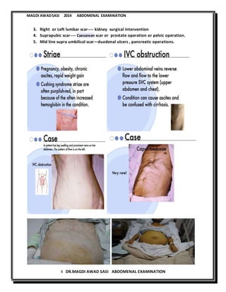 Generalrulesofabdomenalexamination 140413161534-phpapp02 | PDF
