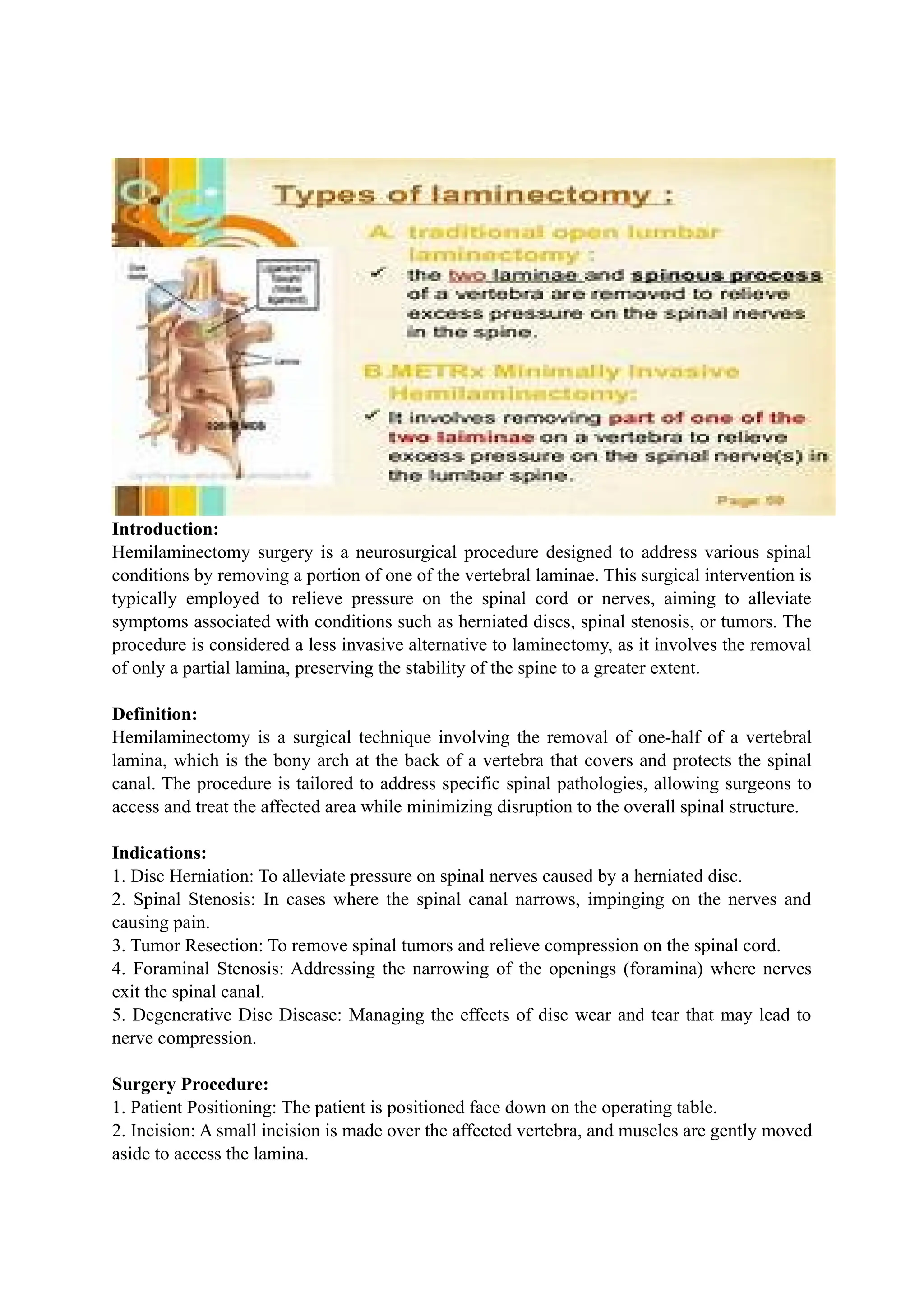 UNIT-II - General surgery NEURO SURGERY | DOCX