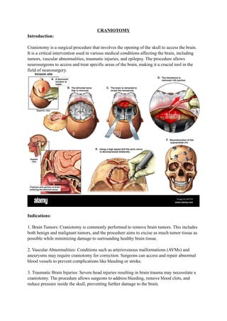 UNIT-II - General surgery NEURO SURGERY | DOCX