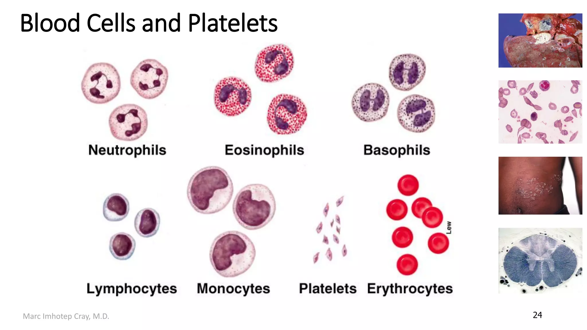 General and Systemic Pathology Concepts-A Global Overview | PDF