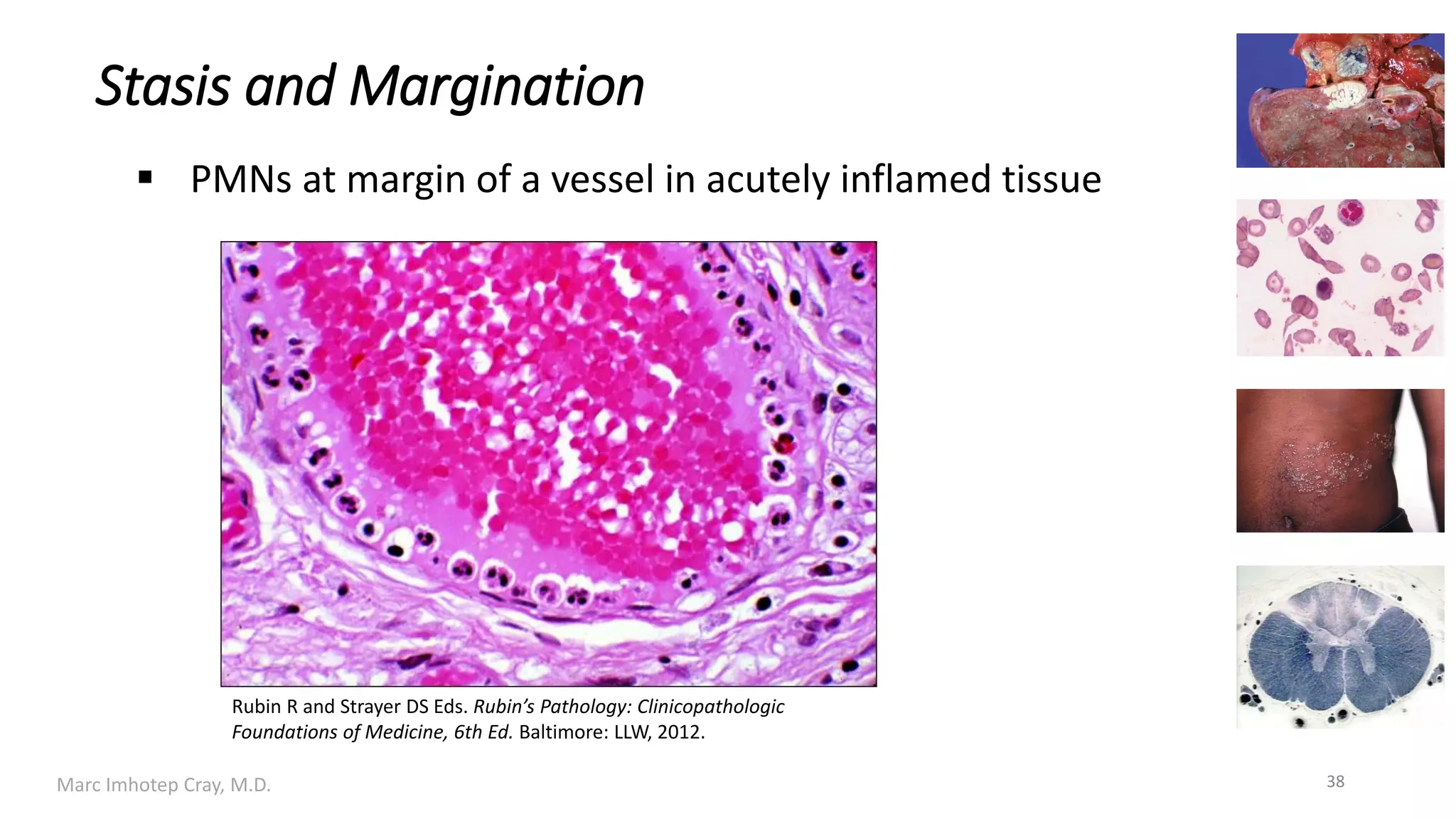 General and Systemic Pathology Concepts-A Global Overview | PDF