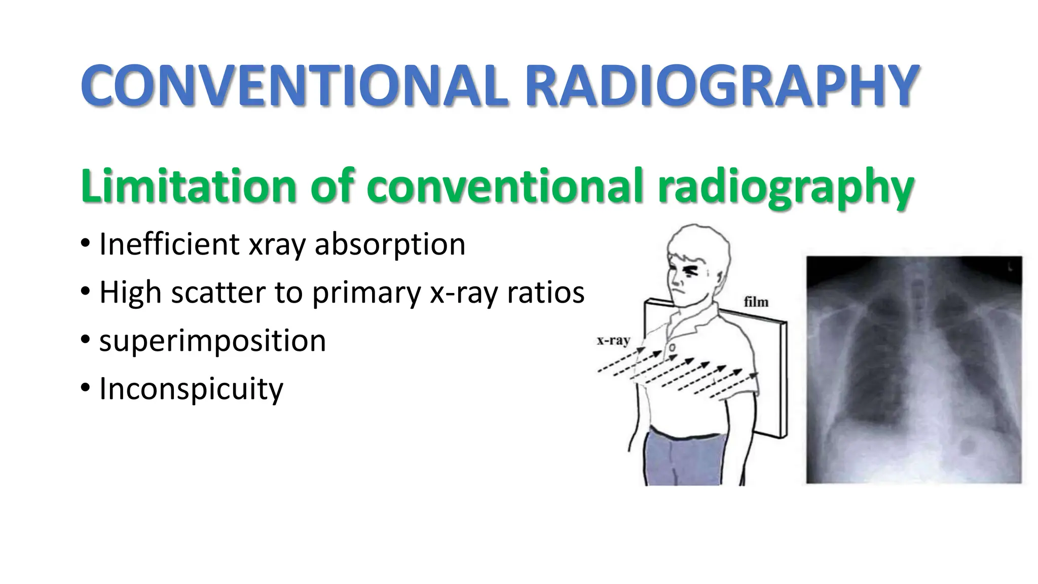 Generation of CT.pptx................... | PPTX