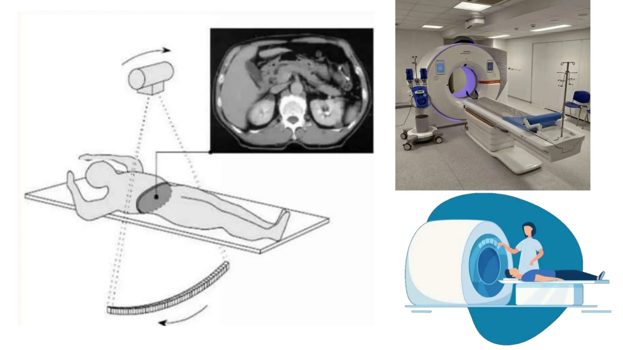 Generation of CT.pptx................... | PPTX