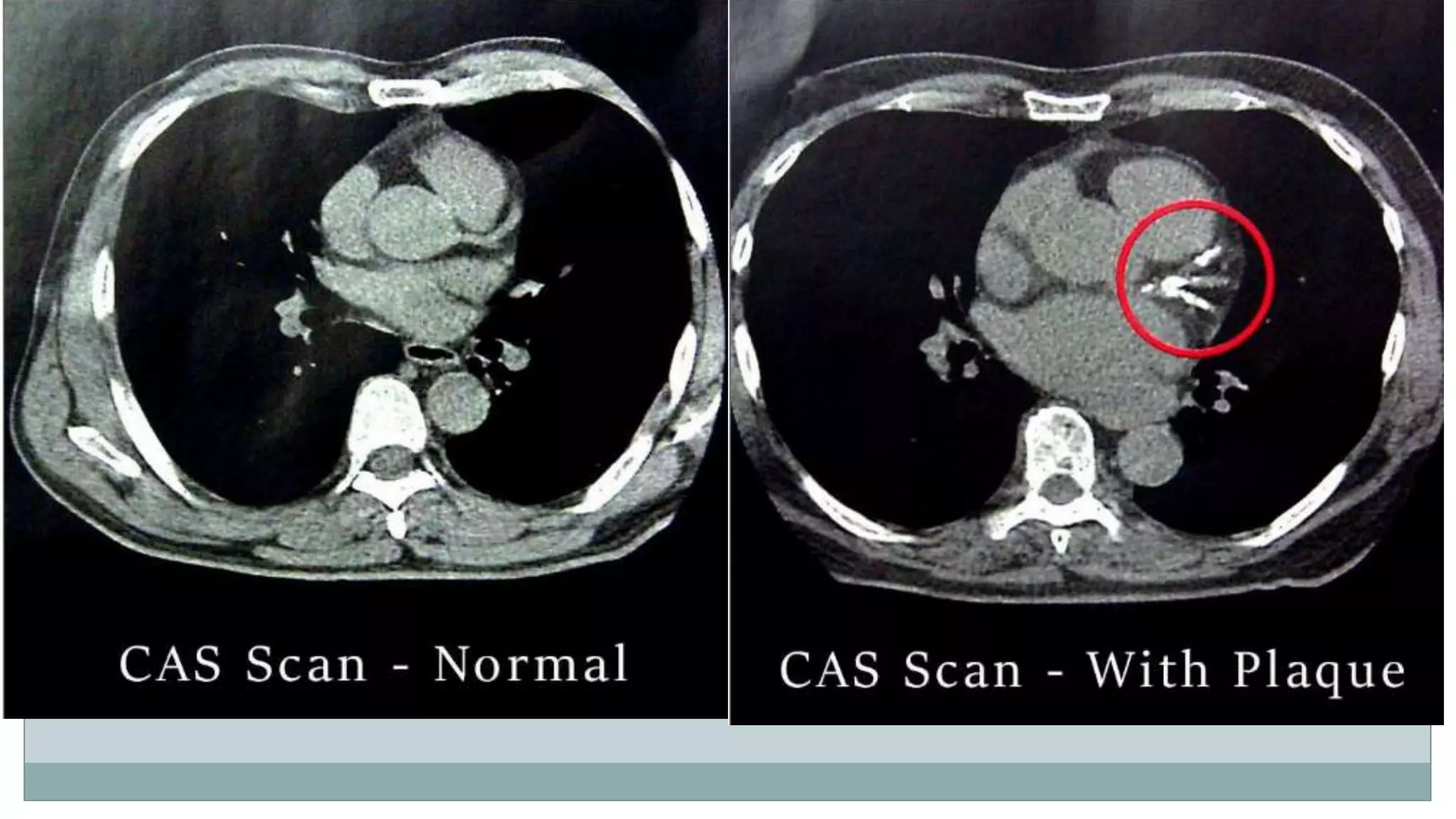 Generations and advancement of CT | PPTX