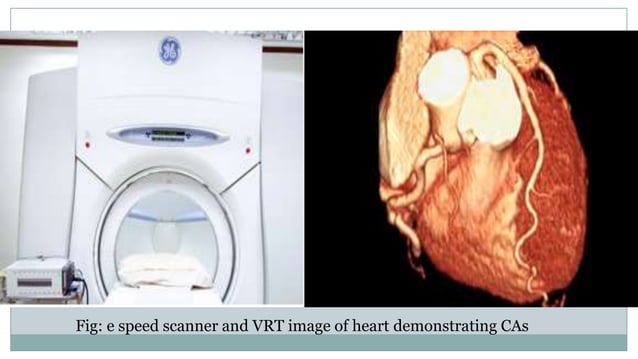 Generations and advancement of CT | PPTX
