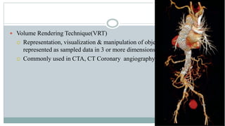 Generations and advancement of CT | PPTX