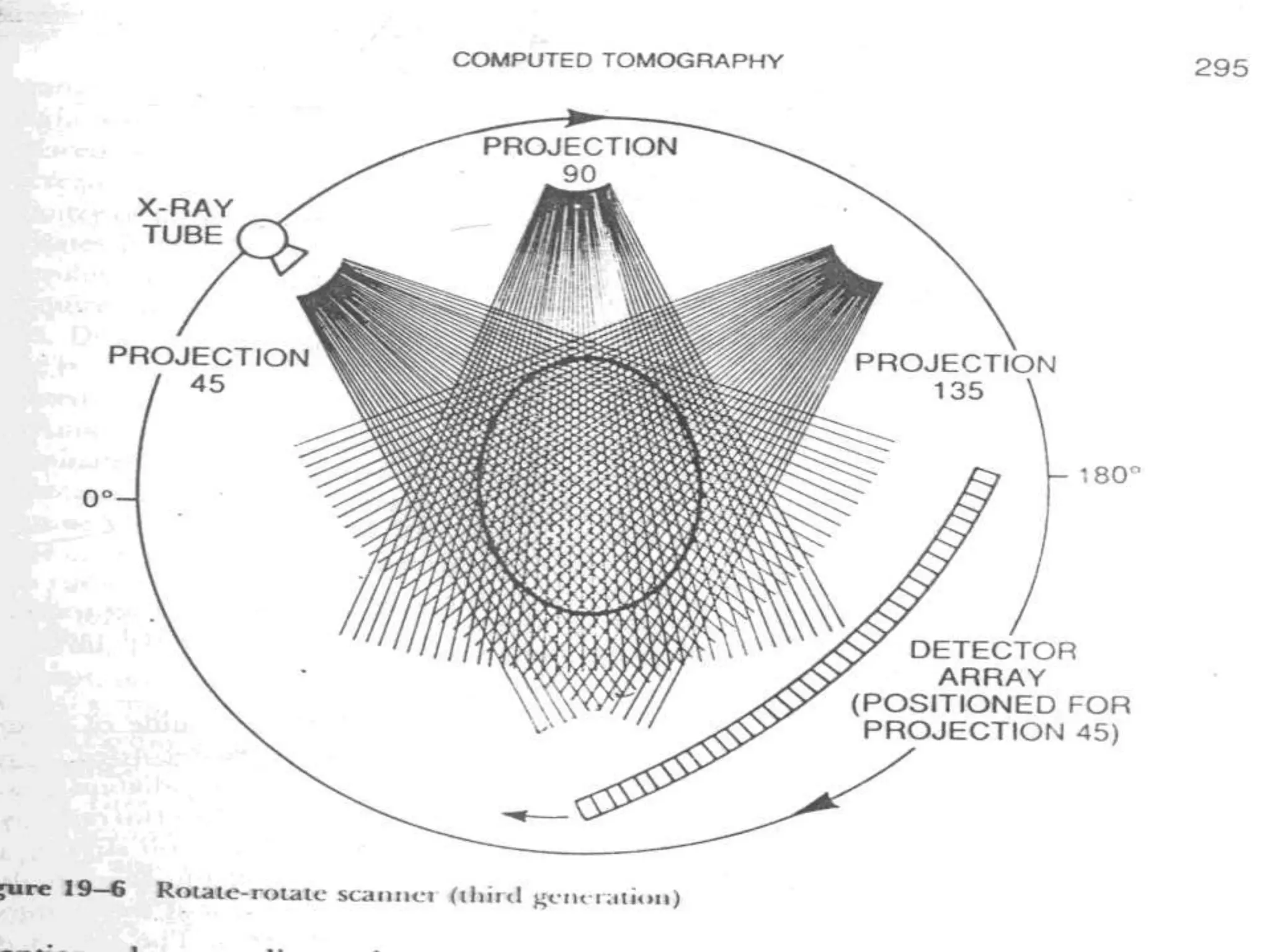 Basics and Generations of computed tomography.pptx