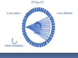 Basics and Generations of computed tomography.pptx | Medical Tests ...