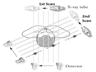 Basics and Generations of computed tomography.pptx