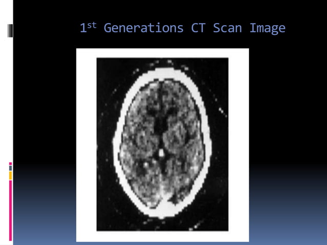 Basics and Generations of computed tomography.pptx | Medical Tests ...