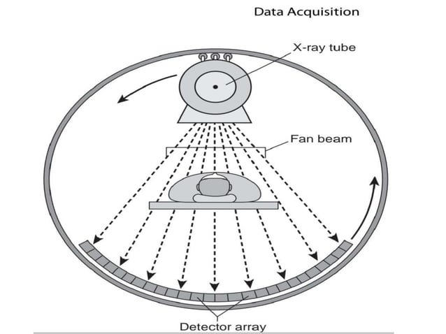 Generations of CT scanner | PPTX