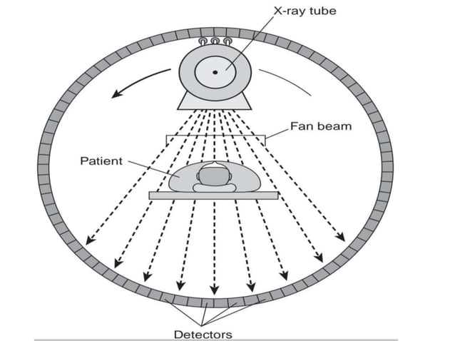 Generations of CT scanner | PPTX