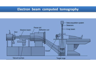 Generations of CT scanner | PPTX