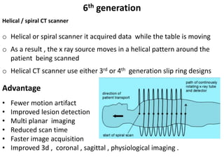 Generations of CT scanner | PPTX