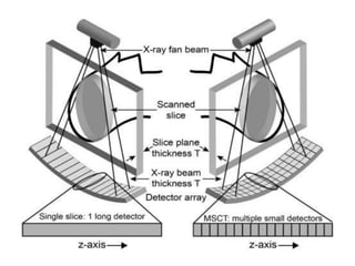 Generations of CT scanner | PPTX