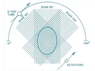 Generations of CT scanner | PPTX