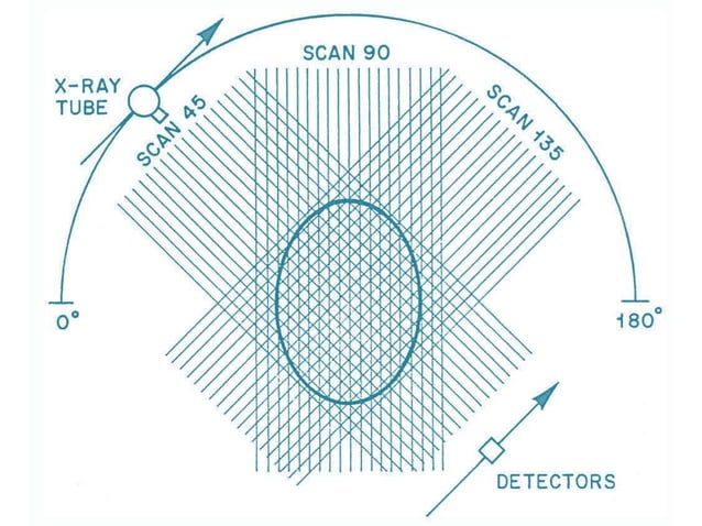 Generations of CT scanner | PPTX