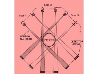 Generations of CT scanner | PPTX