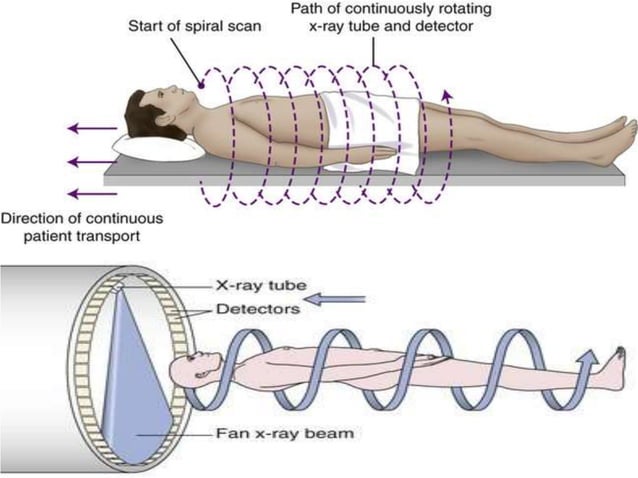 Generations of CT scanner