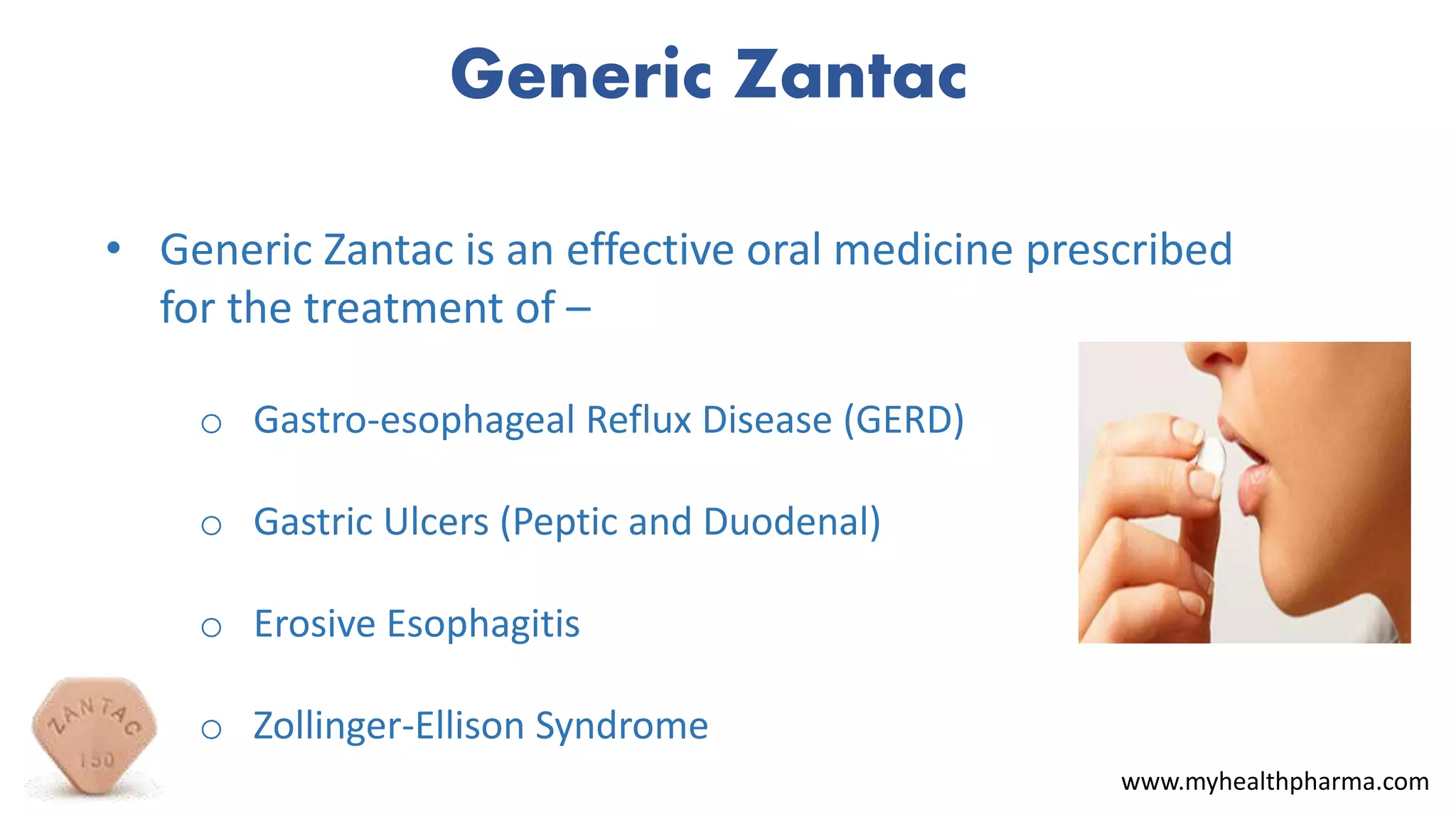 Generic Zantac To Treat Stomach Ulcer | PPTX