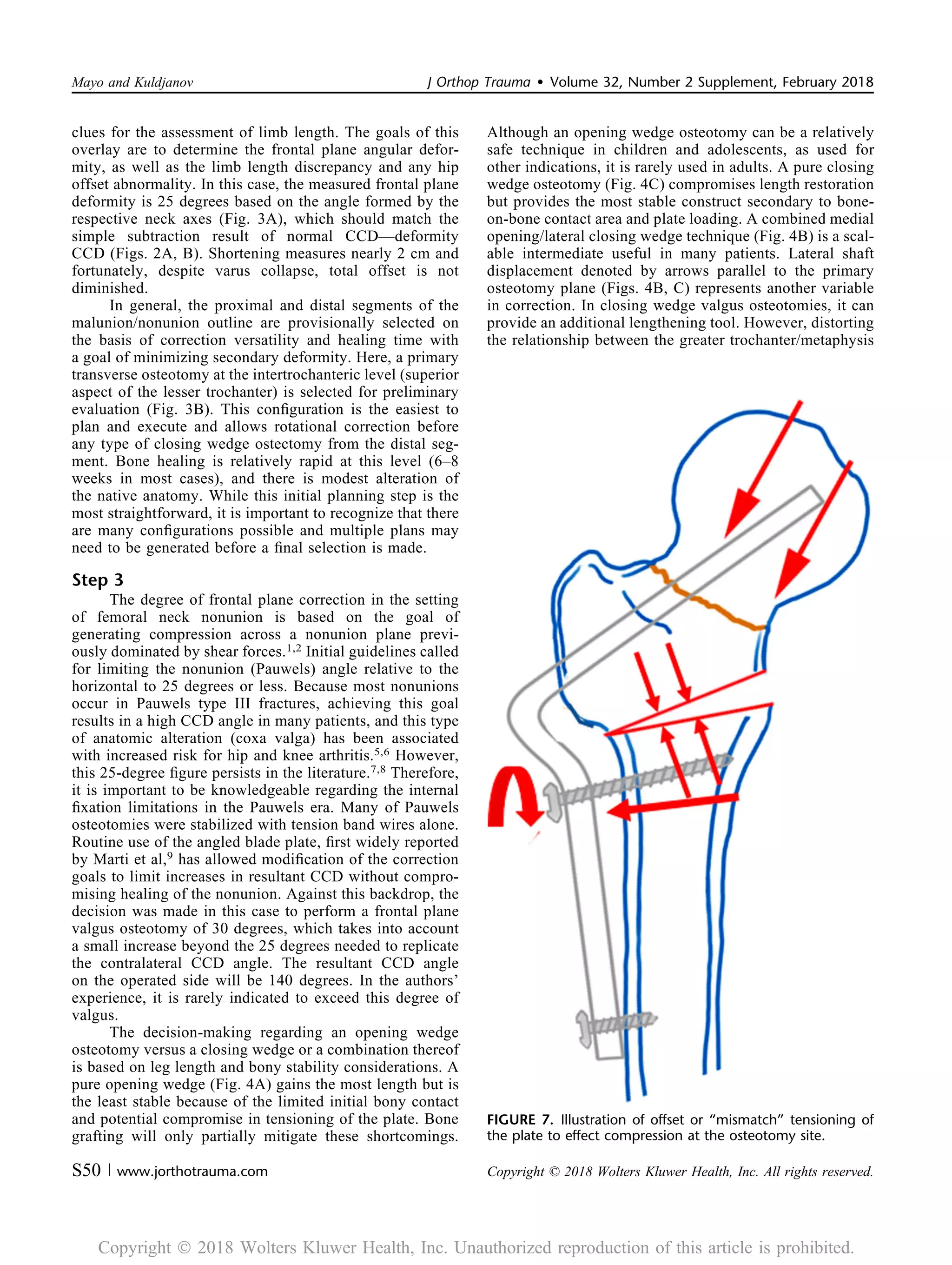 Generic preoperative planning for proximal femoral osteotomy in the ...
