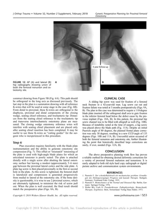 Generic preoperative planning for proximal femoral osteotomy in the ...