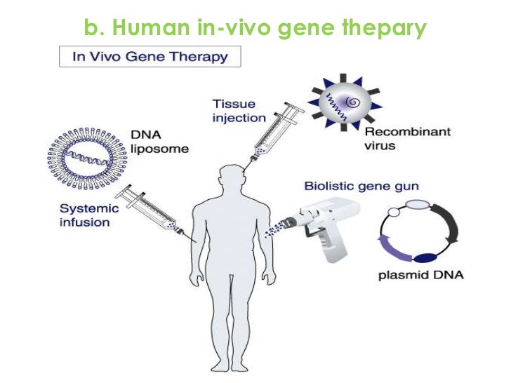 Gene therapy
