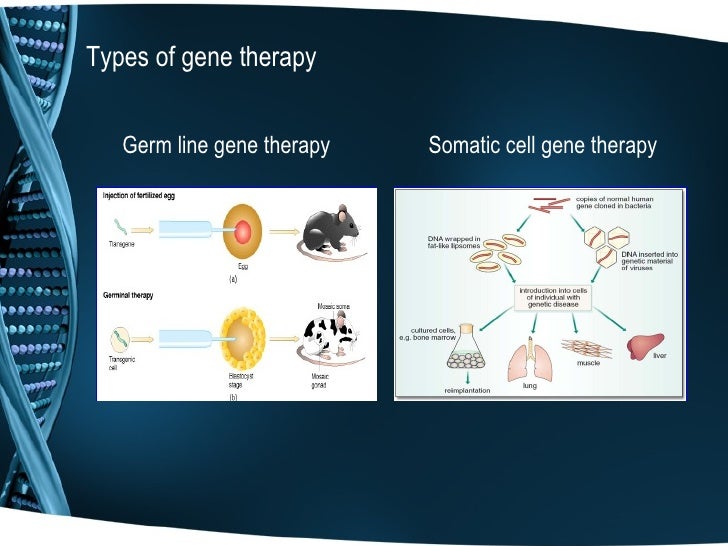 Gene therapy