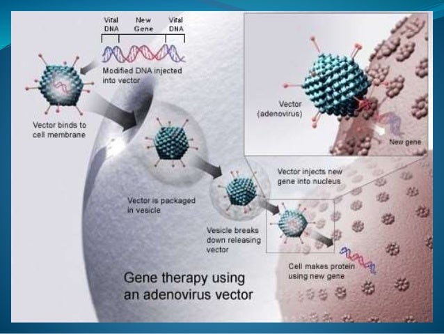 Gene therapy