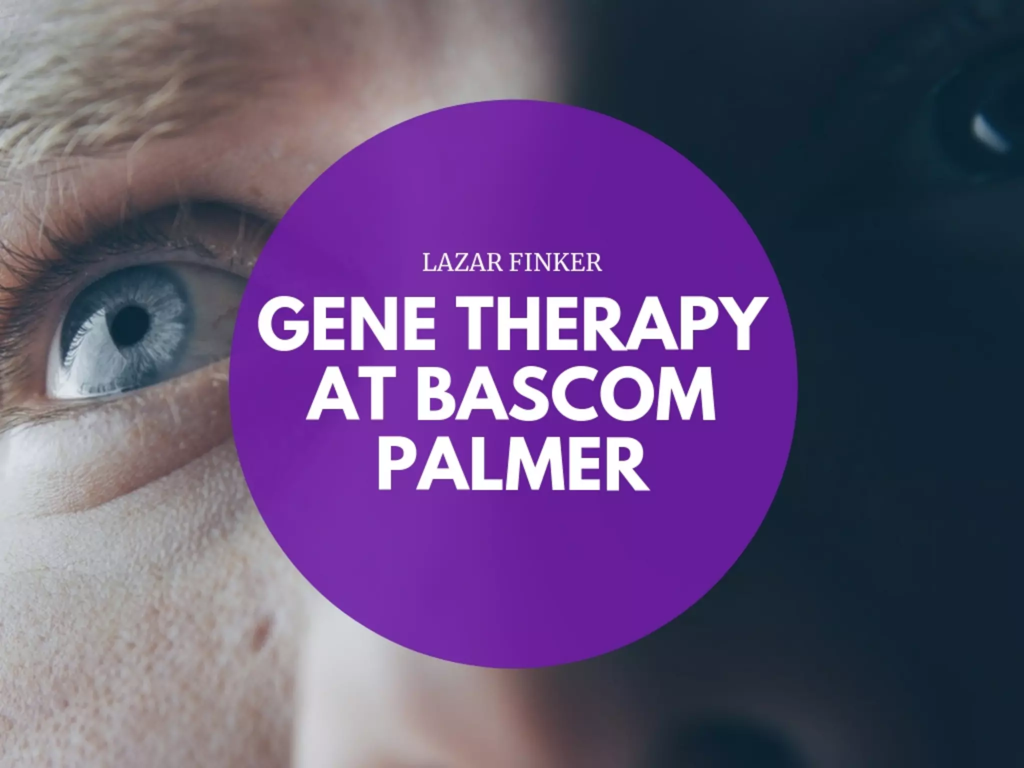 Gene Therapy at Bascom Palmer | PDF