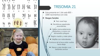 Anomalías Del Numero De Cromosomas Pptx