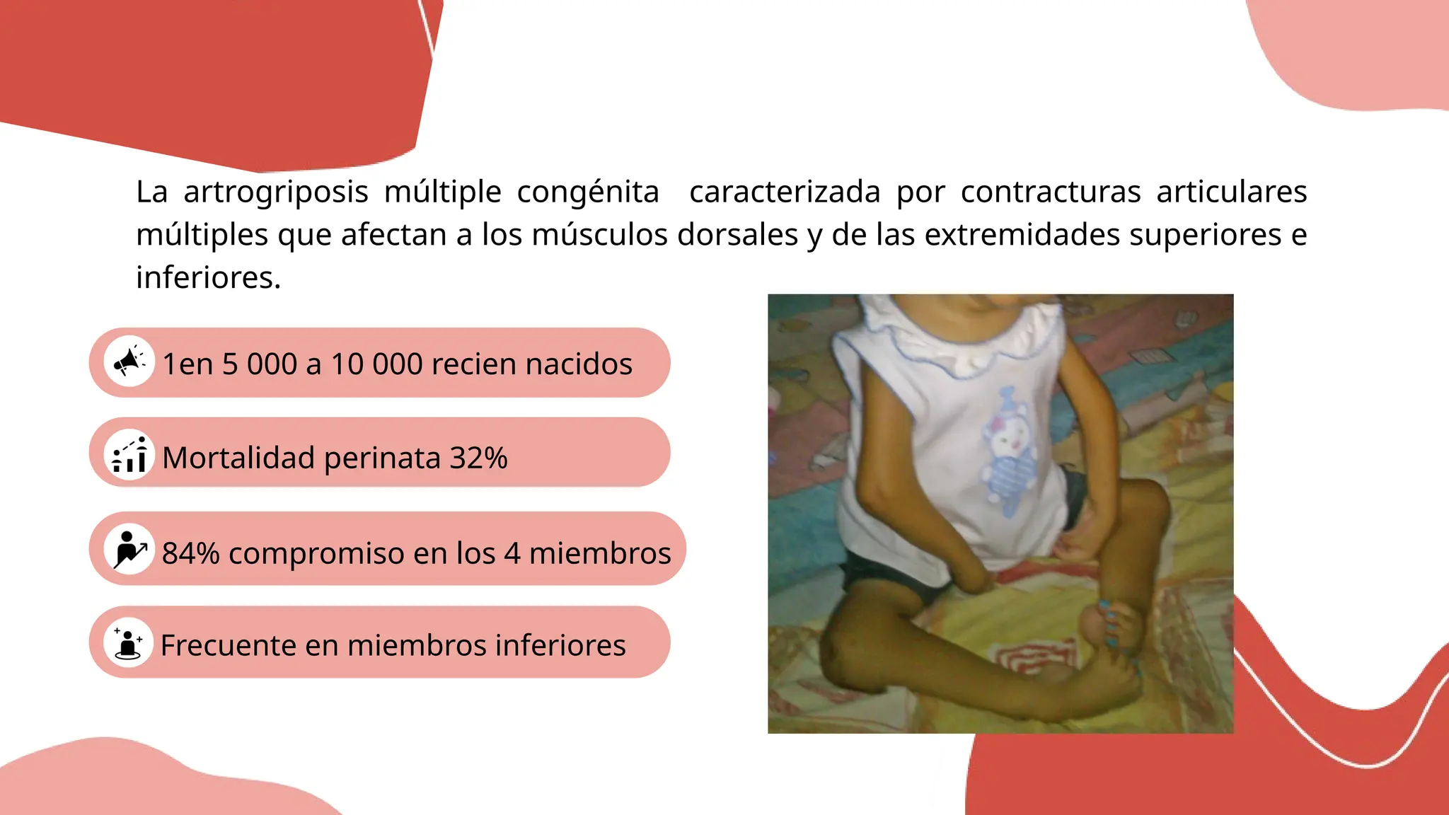 ARTROGRIPOSIS MÚLTIPLE CONGÉNITA GENETICA.pptx